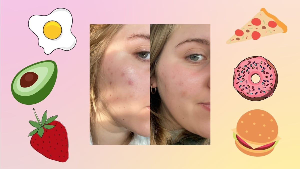 Can an anti-inflammatory diet help with cystic acne? We tried it out ...